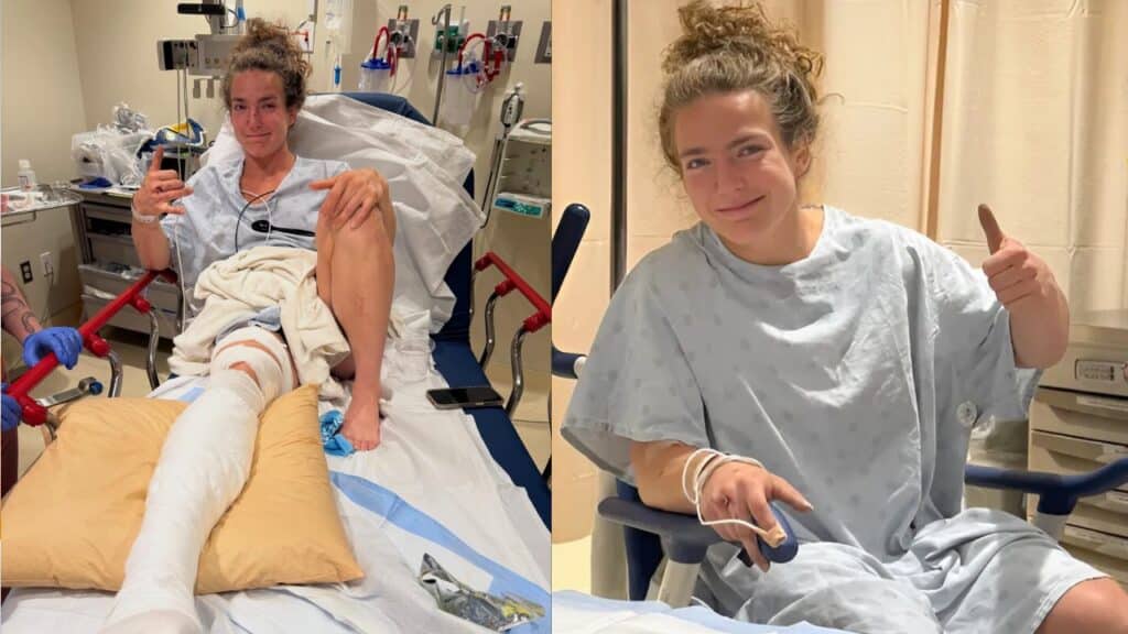 Alex Gazan Fractures Leg in Car Crash Days After NorCal Victory: What ...
