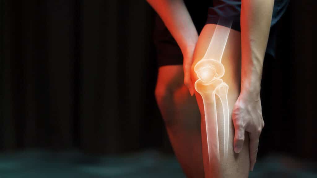 Bryan Johnson Has Denser Bones Than 99% of People His Age — Here’s His ...